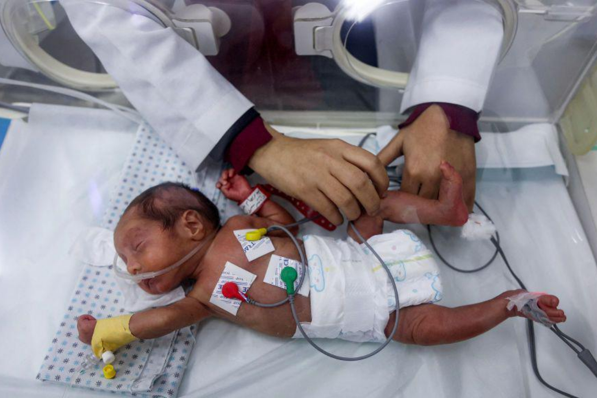 Newborn suffers serious burns due to overheated incubator
